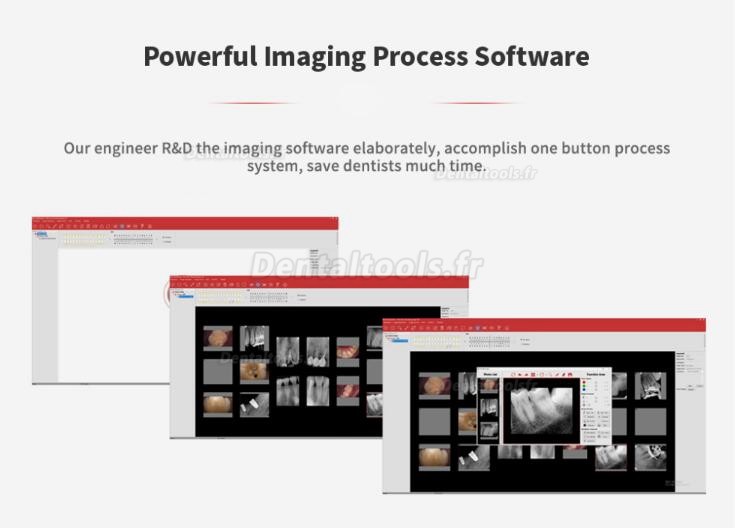 Vente de Handy HDS-500 Scanner de plaque de phosphore Scanner de ...